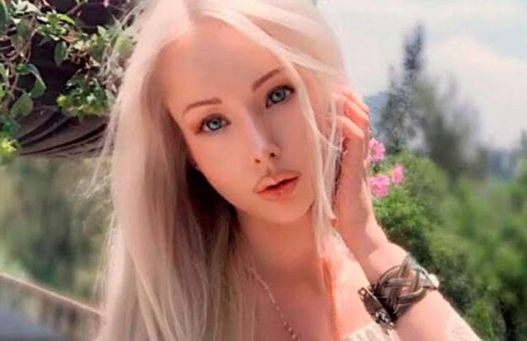 Foto: Mirá como lucía la “Barbie humana” antes de las operaciones y sin ...